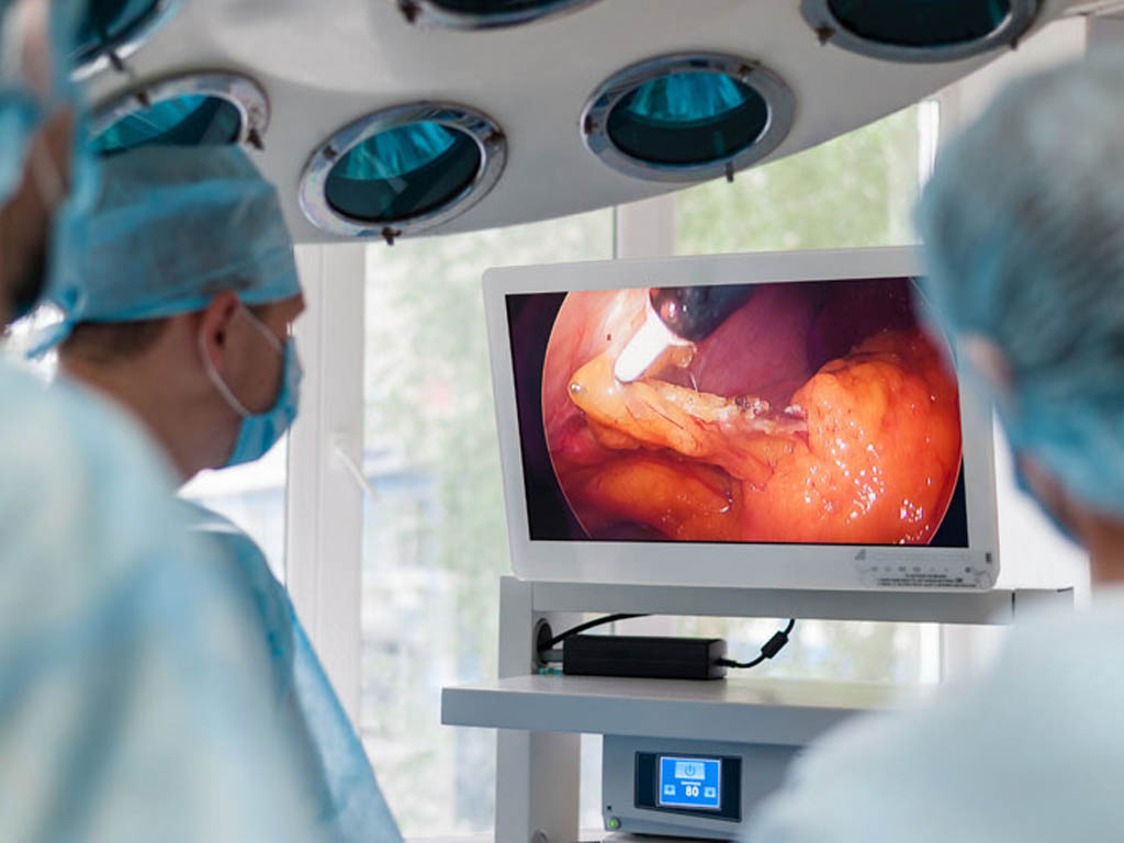 ¿Qué es la Ecoendoscopia? - Hospital San Carlos